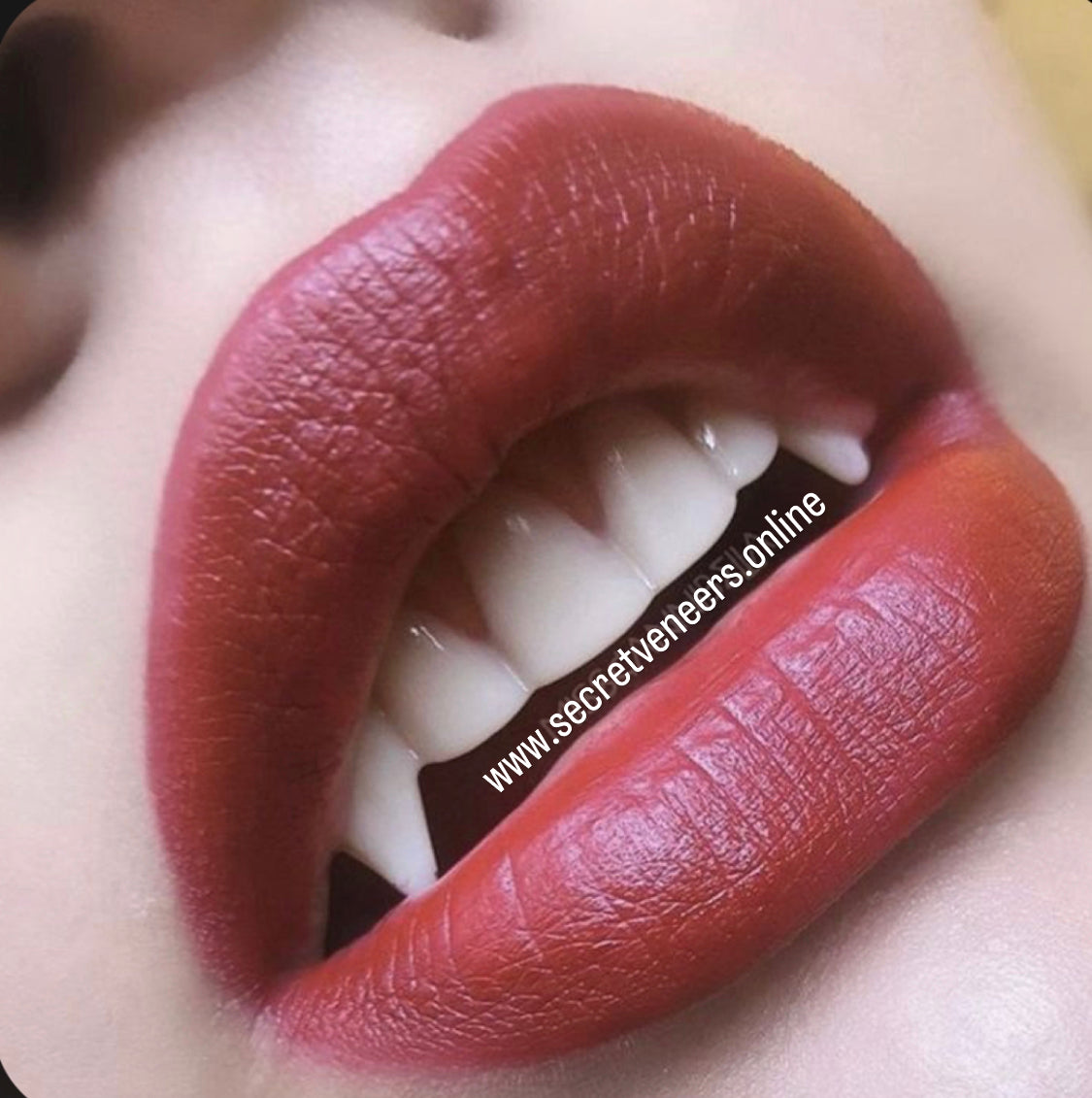 Custom fit Vampire fangs & impression kit – Secret Veneers